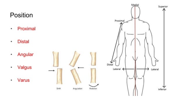 Orthopaedic terminology | PPTX