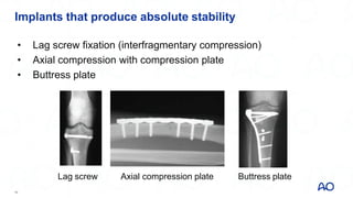 2.1 Absolute stability-dikonversi.pptx
