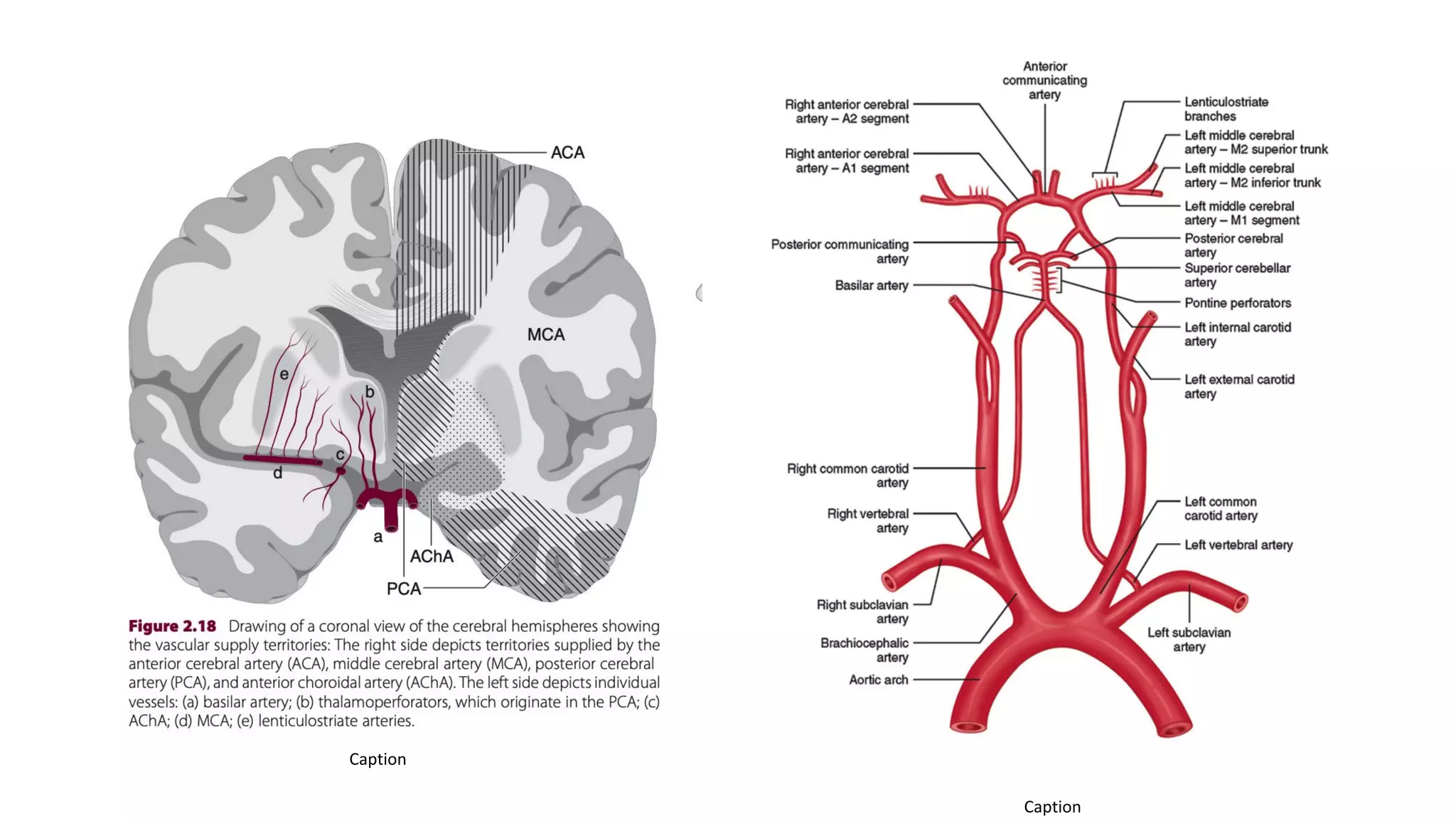 2. Stroke Localisation.pdf