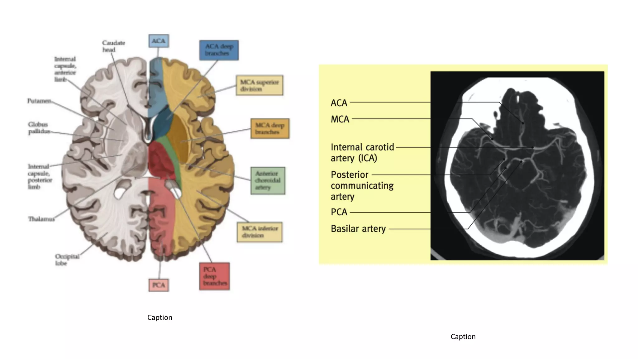 2. Stroke Localisation.pdf