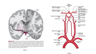 2. Stroke Localisation.pdf