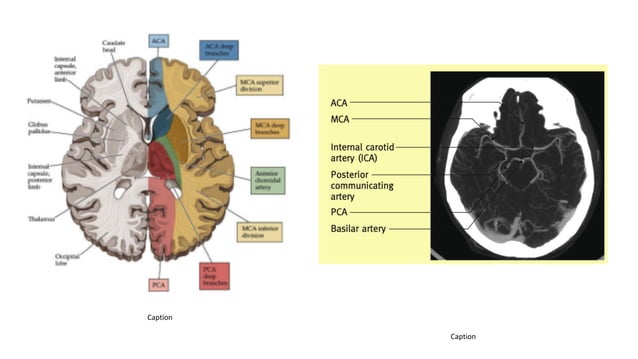 2. Stroke Localisation.pdf