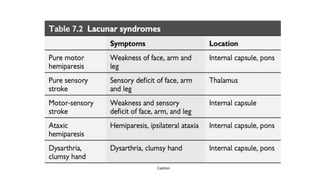 2. Stroke Localisation.pdf
