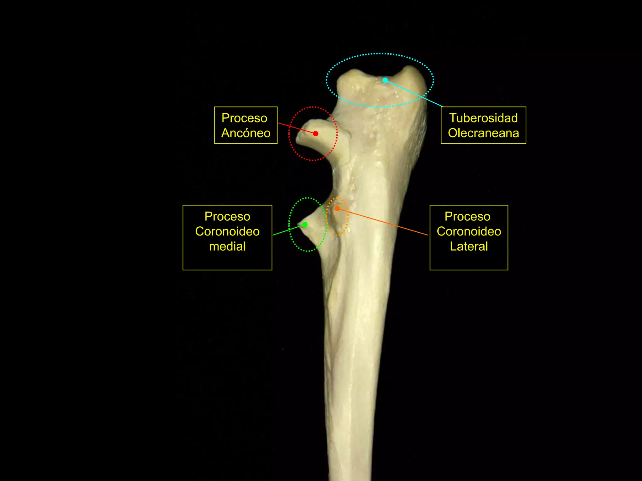 2. osteologia Miembro Ant. perro.pptx