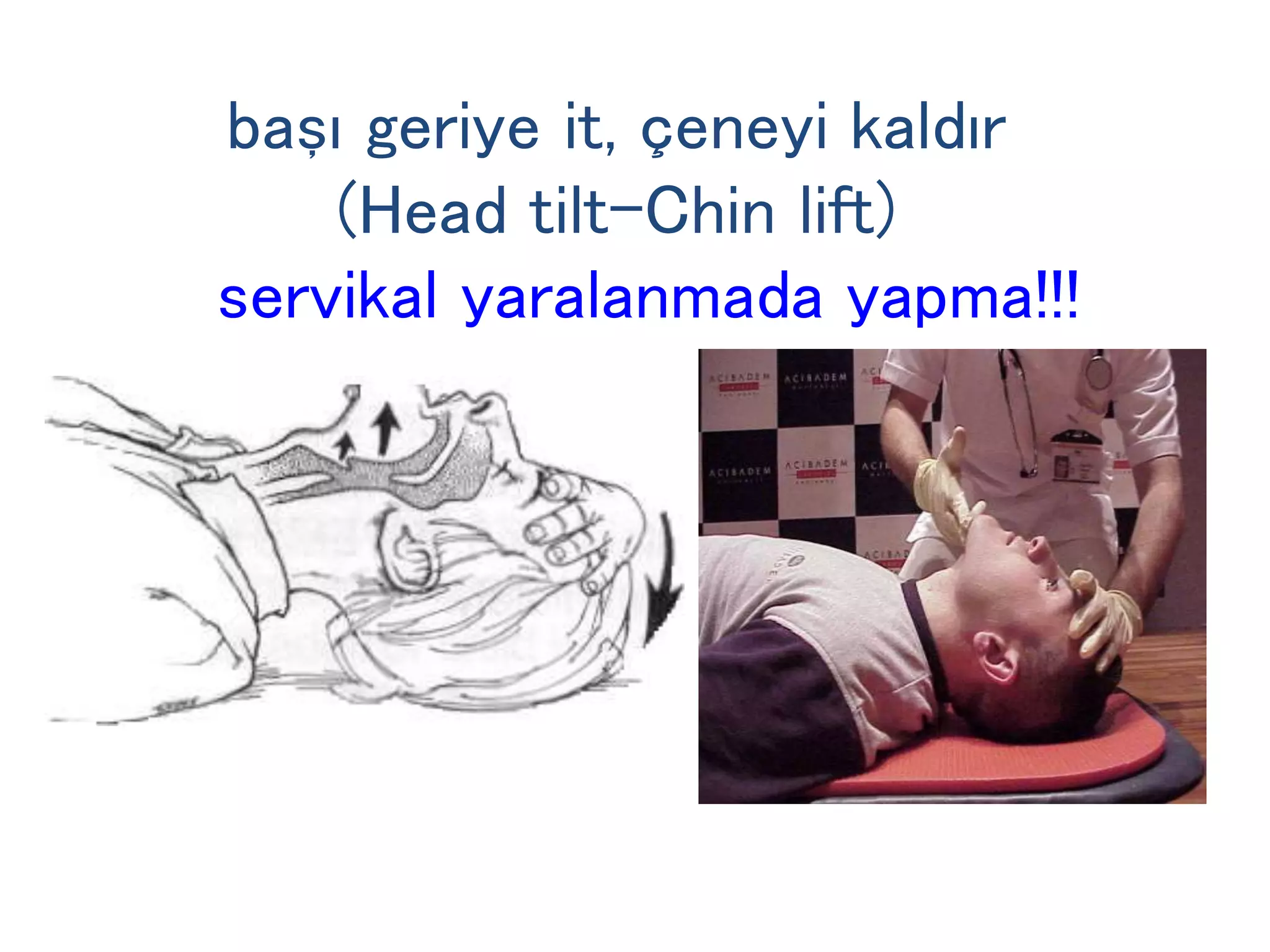 2. hafta Baş İmmobilizasyonu.pptx