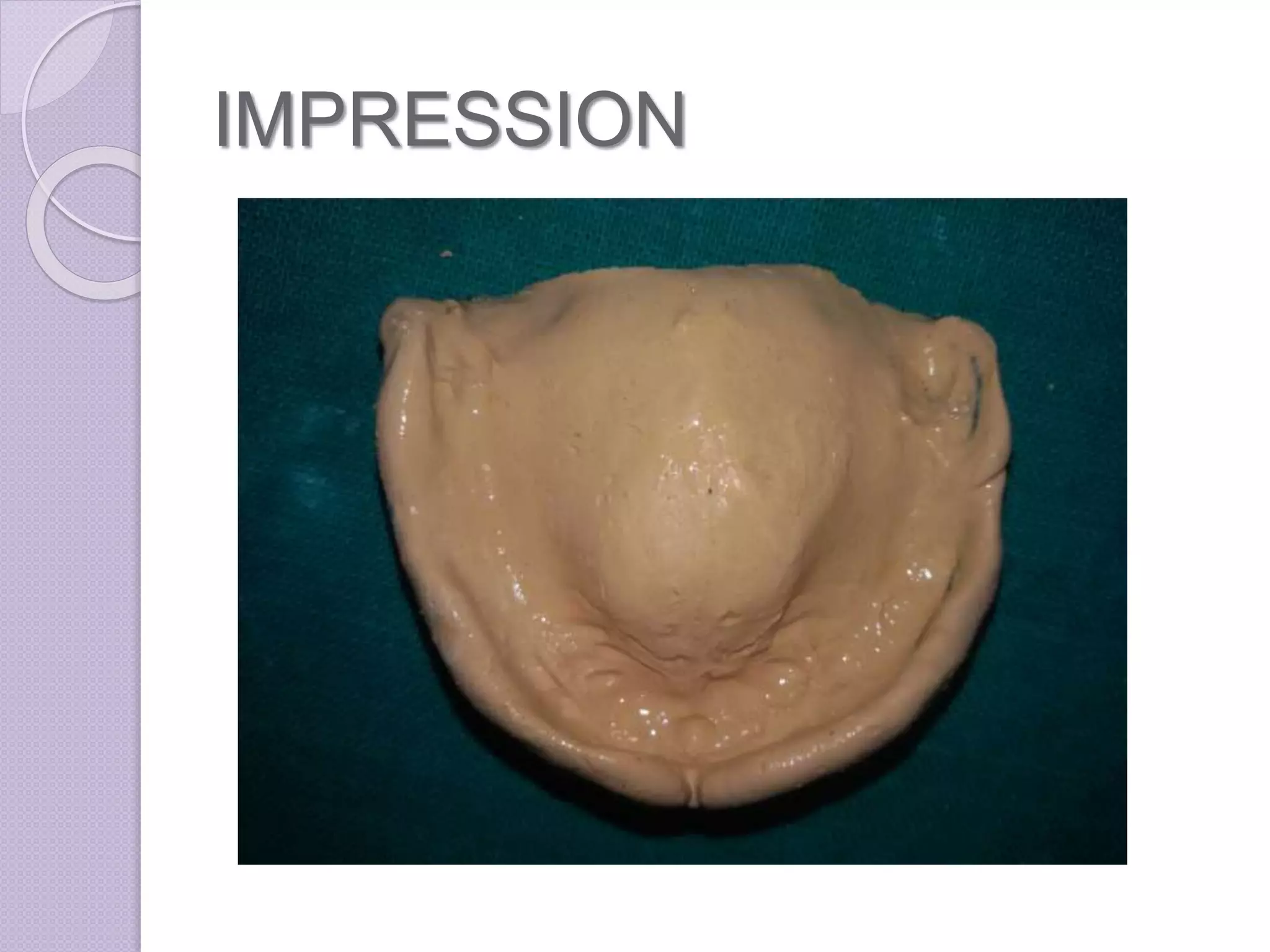2.VIRTUAL IMPRESSIONS AND VIRTUAL AND STEREOLITHOGRAPHIC MODELS.pptx