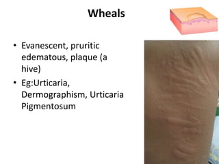 2. Approach to dermatologic diagnosis.pptx | Skin and Dermatology ...