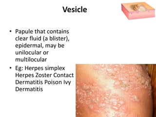 2. Approach to dermatologic diagnosis.pptx | Skin and Dermatology ...