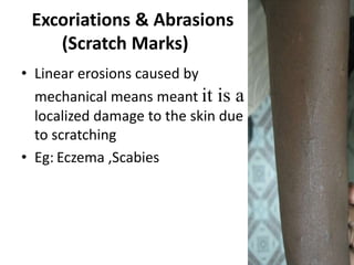 2. Approach to dermatologic diagnosis.pptx | Skin and Dermatology ...