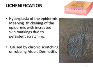 2. Approach to dermatologic diagnosis.pptx