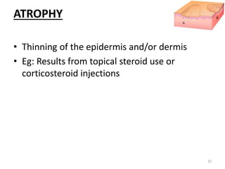 2. Approach to dermatologic diagnosis.pptx | Skin and Dermatology ...