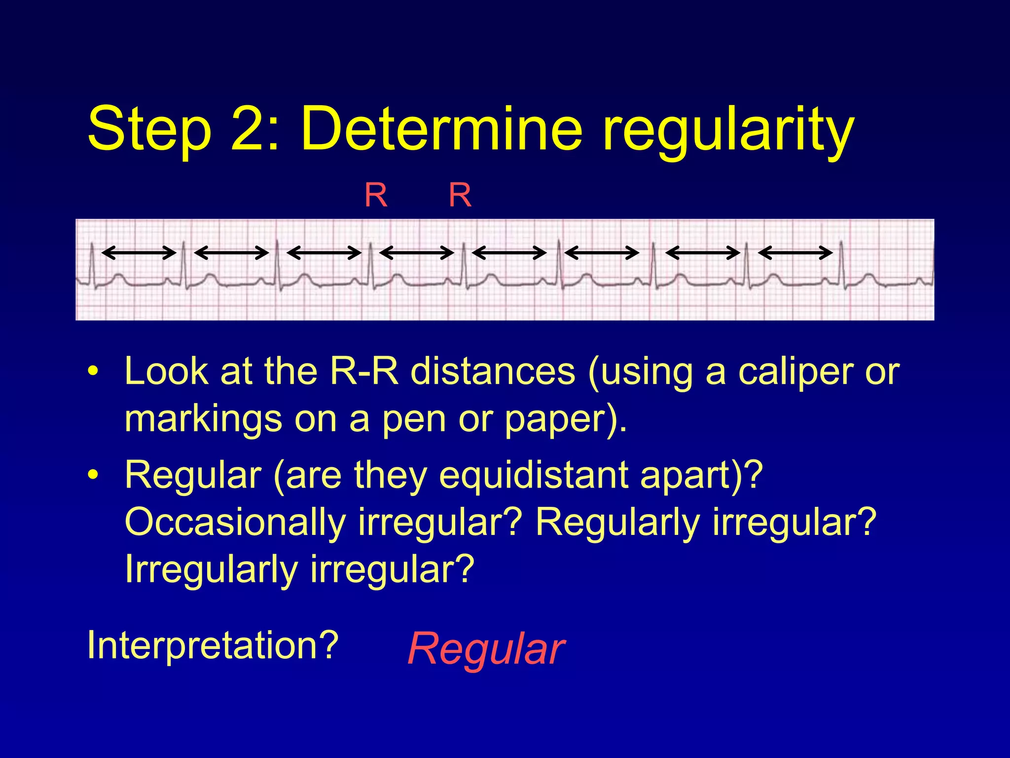 2.How to analyze a rhythm.ppt