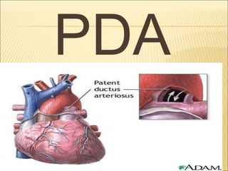 2. PDA&AVS-.ppt