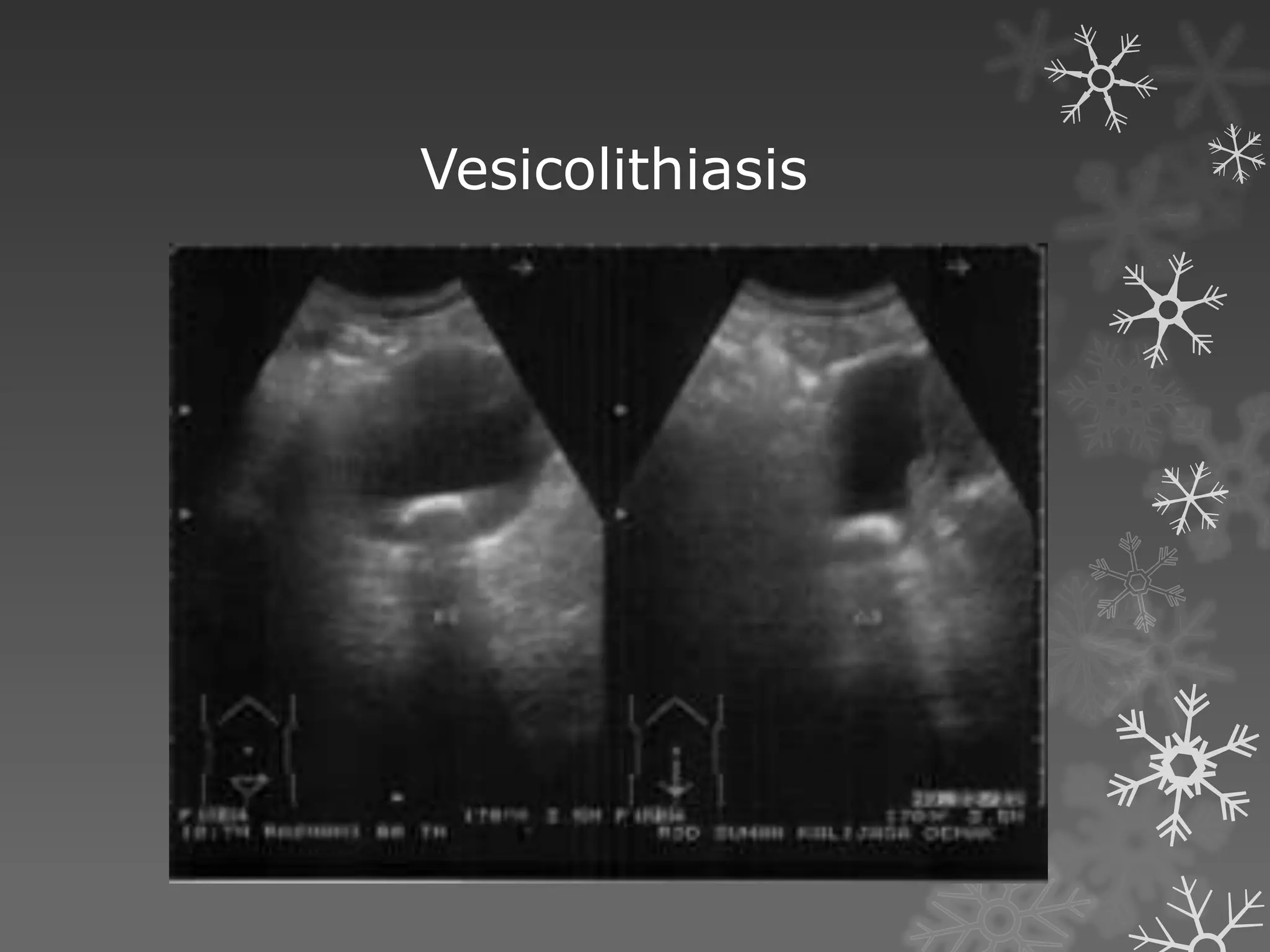 2. pemeriksaan penunjanhg radiologi pada kelainan urogenital.pdf