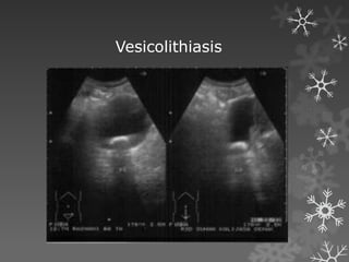 2. pemeriksaan penunjanhg radiologi pada kelainan urogenital.pdf