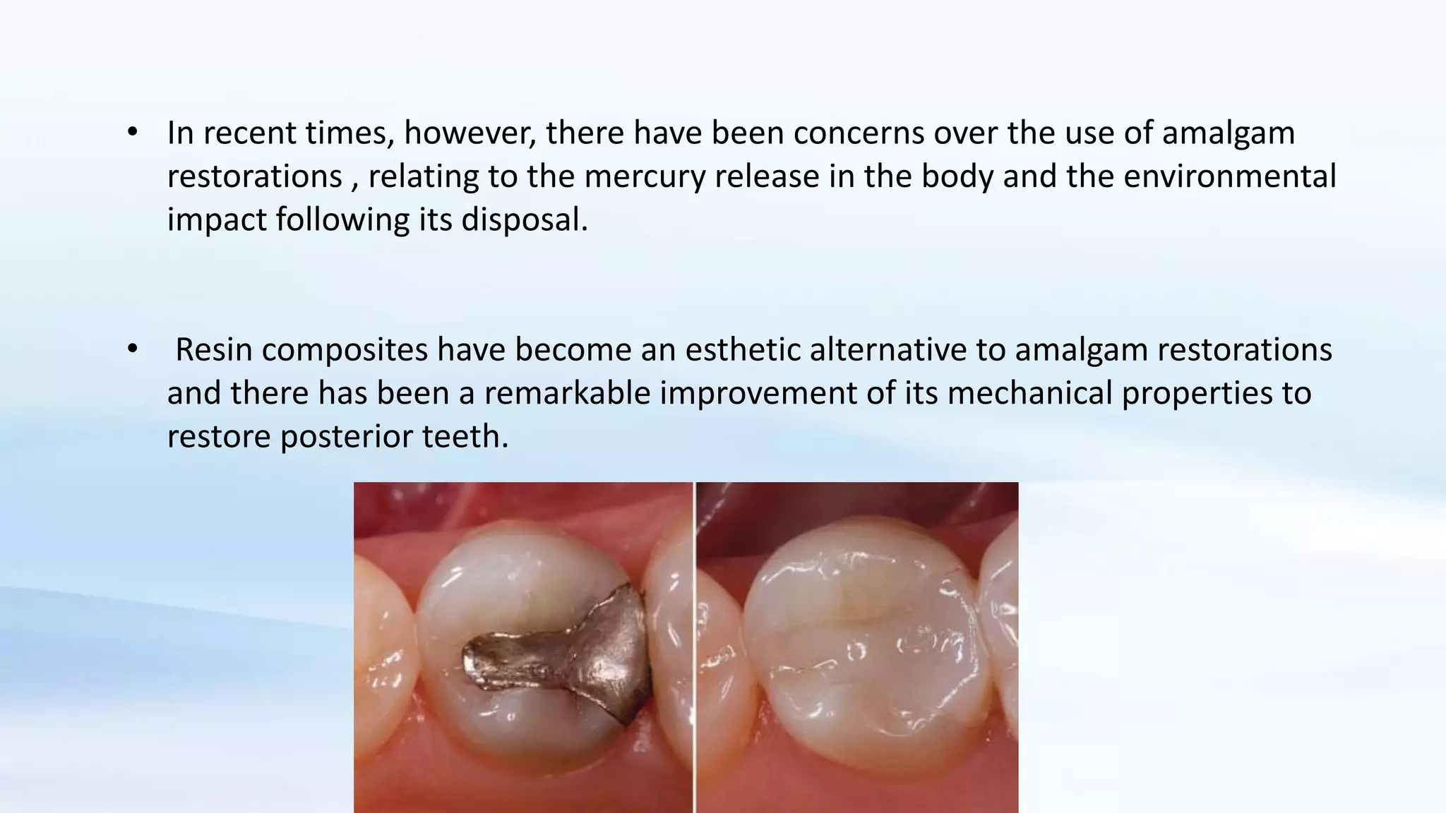 Amalgam and Composite | PPTX | Oral care | Personal Care
