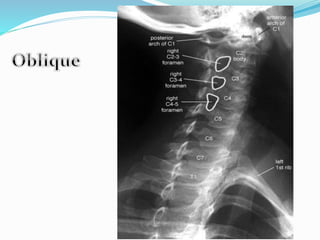 Radiological anatomy-spine.pdf