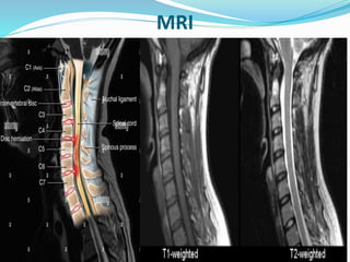 Radiological anatomy-spine.pdf