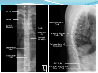 Radiological anatomy-spine.pdf