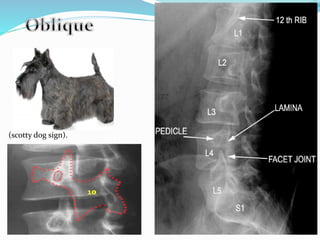 Radiological anatomy-spine.pdf