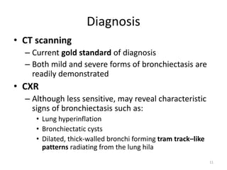2.Bronchiectasis.pptx
