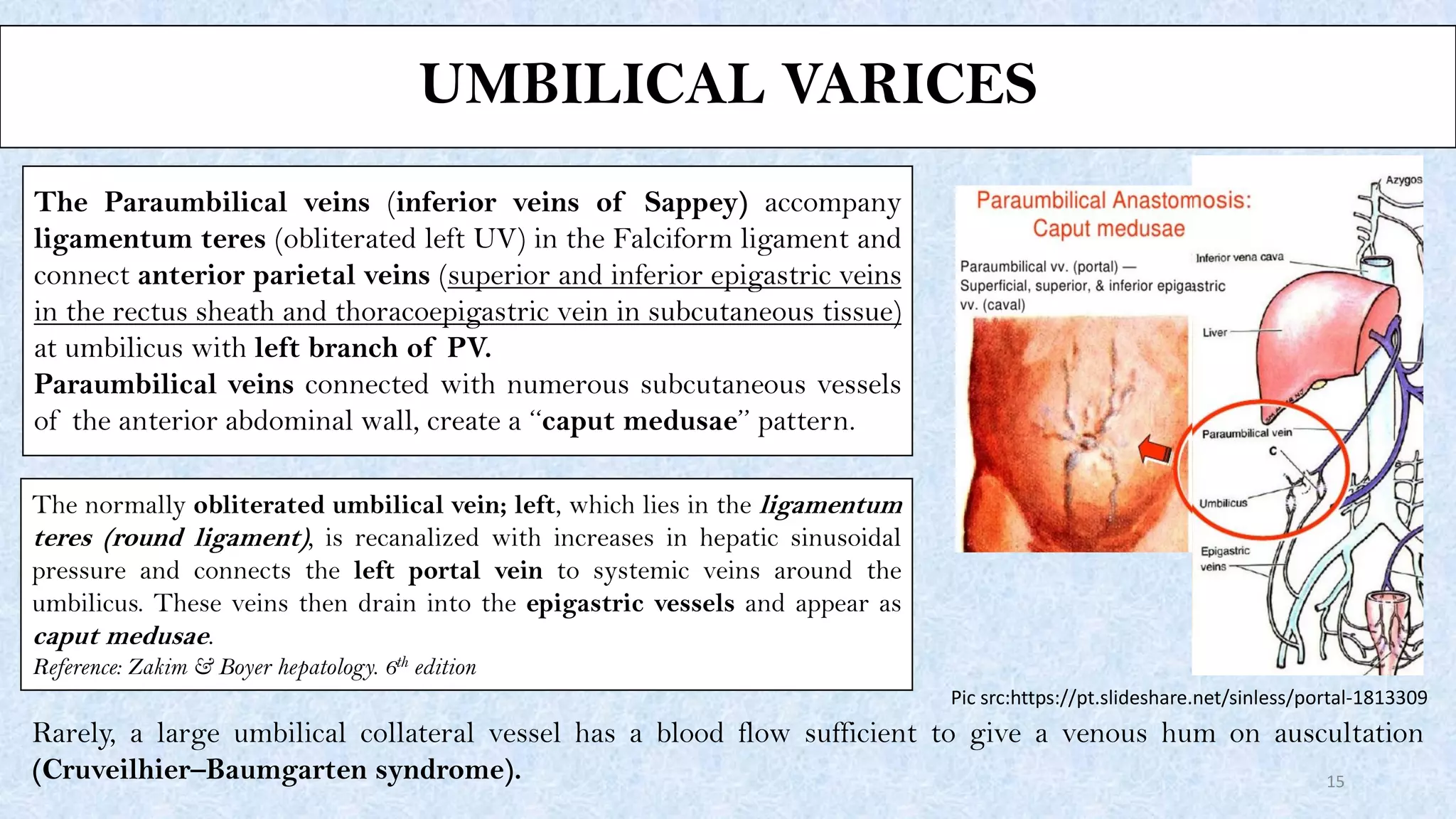 2. PORTAL HYPERTENSION | PDF