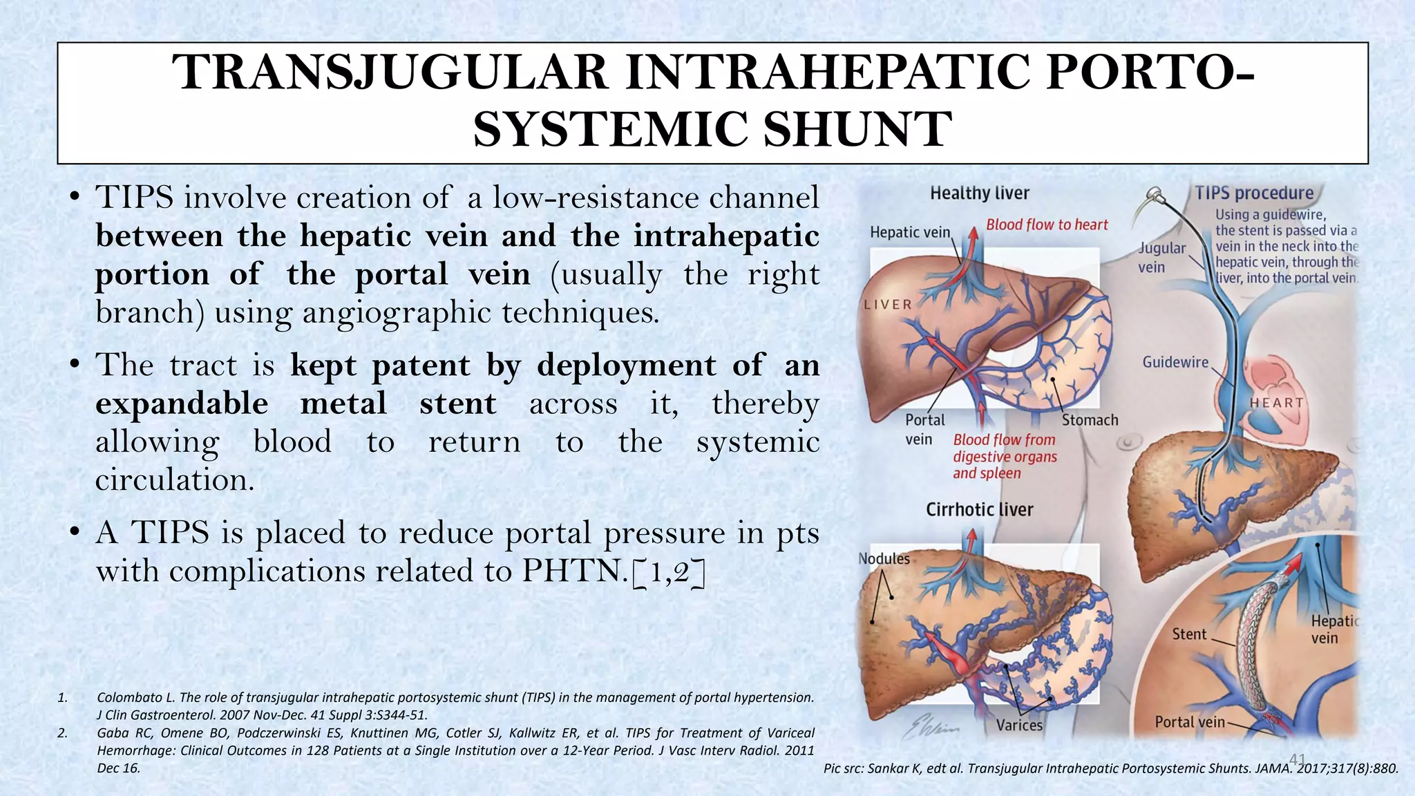 2. PORTAL HYPERTENSION | PDF