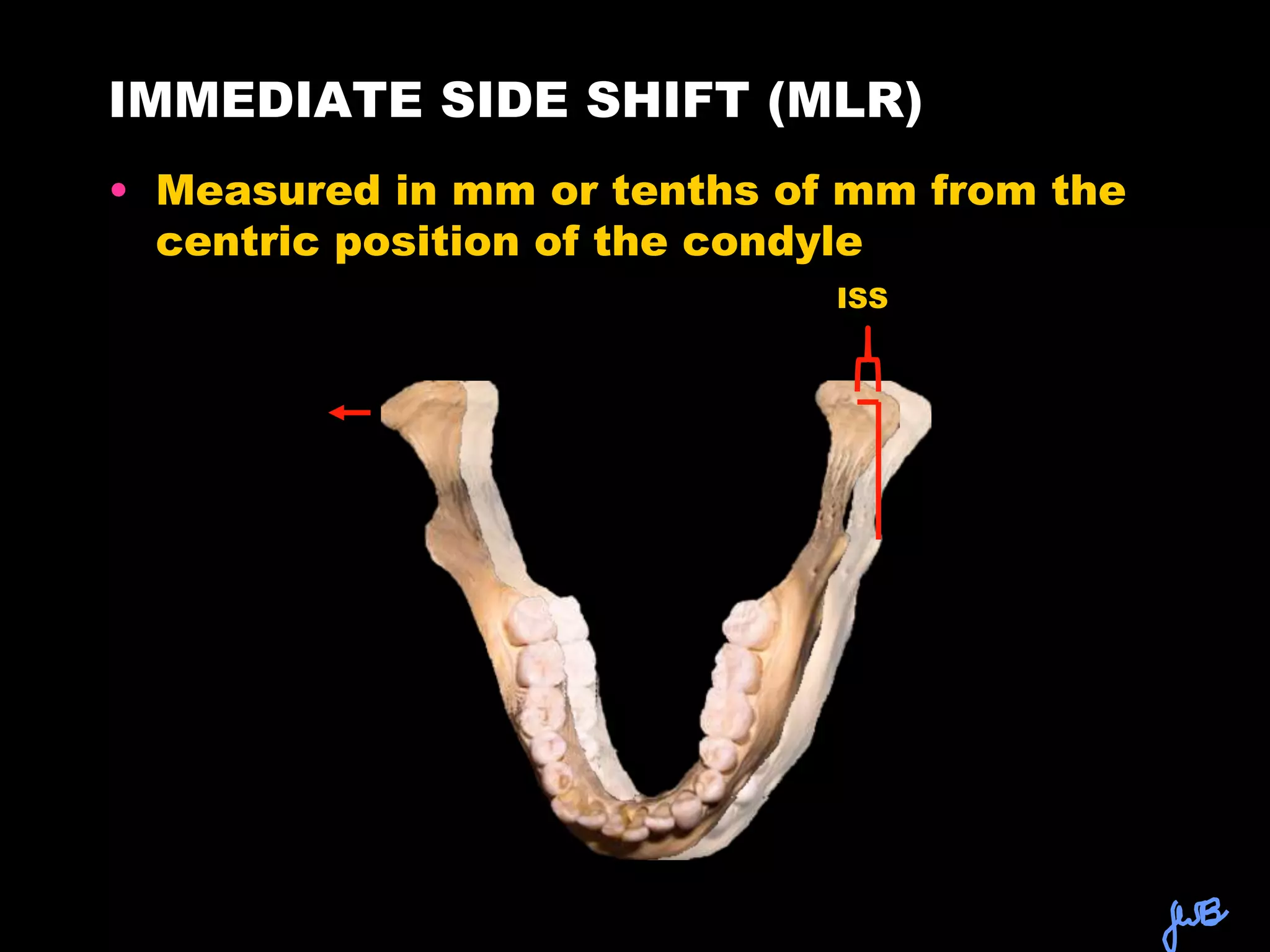zTHE DENTAL ARTICULATOR.ppt