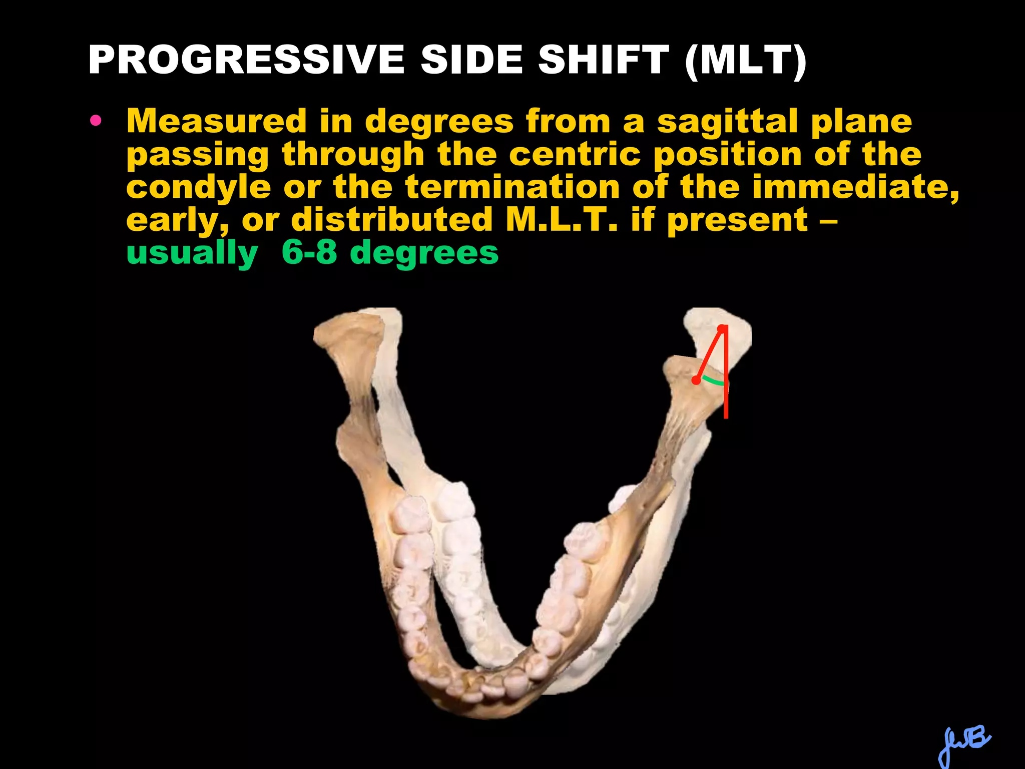 zTHE DENTAL ARTICULATOR.ppt