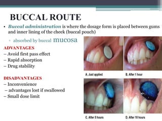 2. Routes of Drug Administration.pptx