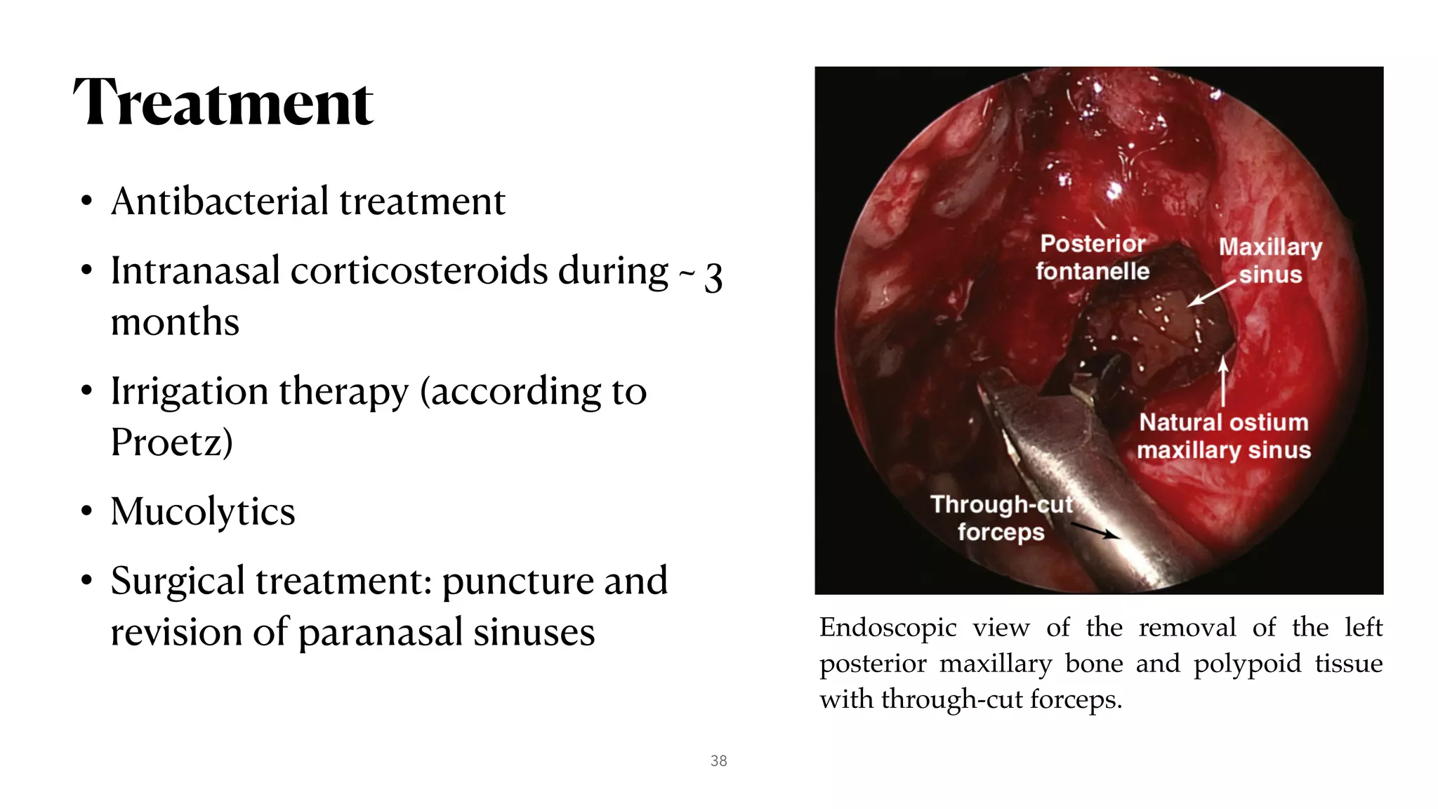 2. Sinuses Pathology 21-22 (1).pdf