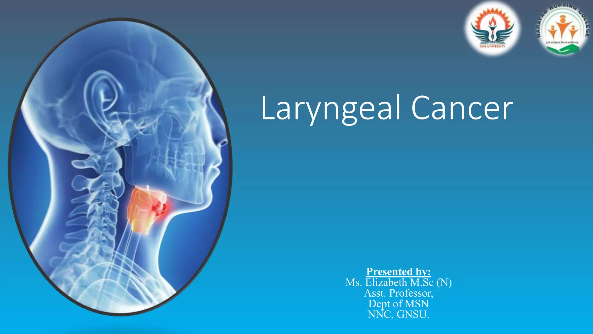 2. laryngeal Cancer - easy explanation | PPTX | Cancer | Diseases and ...