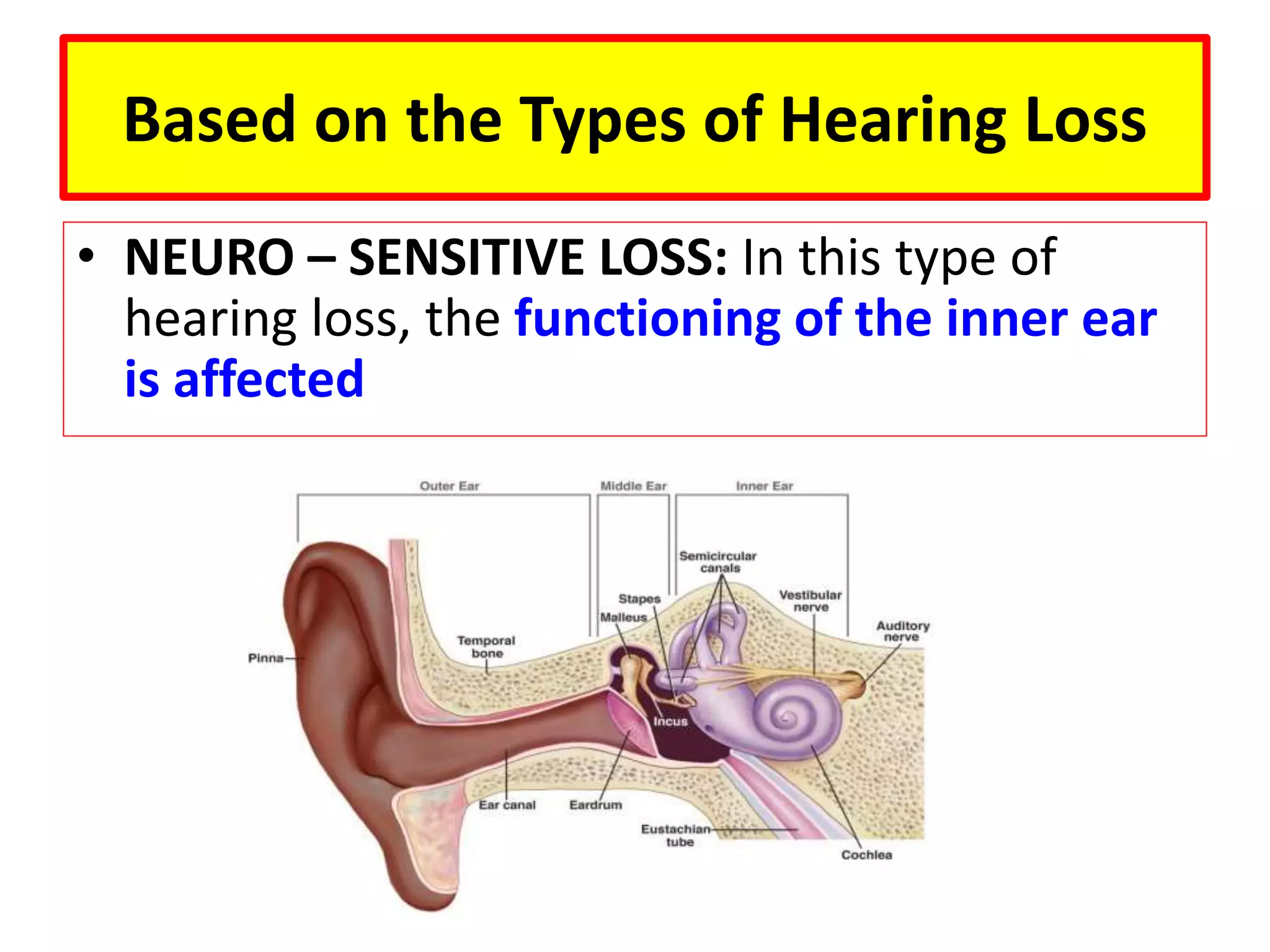 Hearing Impairment Physical Disability.pptx