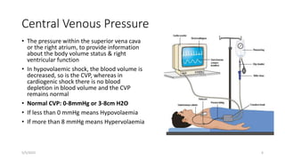2. Hypovolemic, Septic and Cardiogenic Shock.pptx