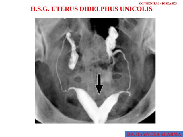 2.2 - Congenital Deformities.pdf