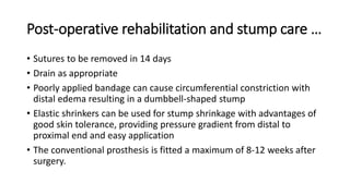 2. Amputation.pptx