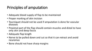 2. Amputation.pptx