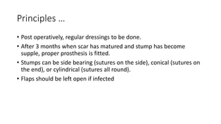 2. Amputation.pptx