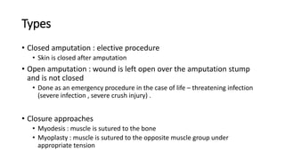 2. Amputation.pptx