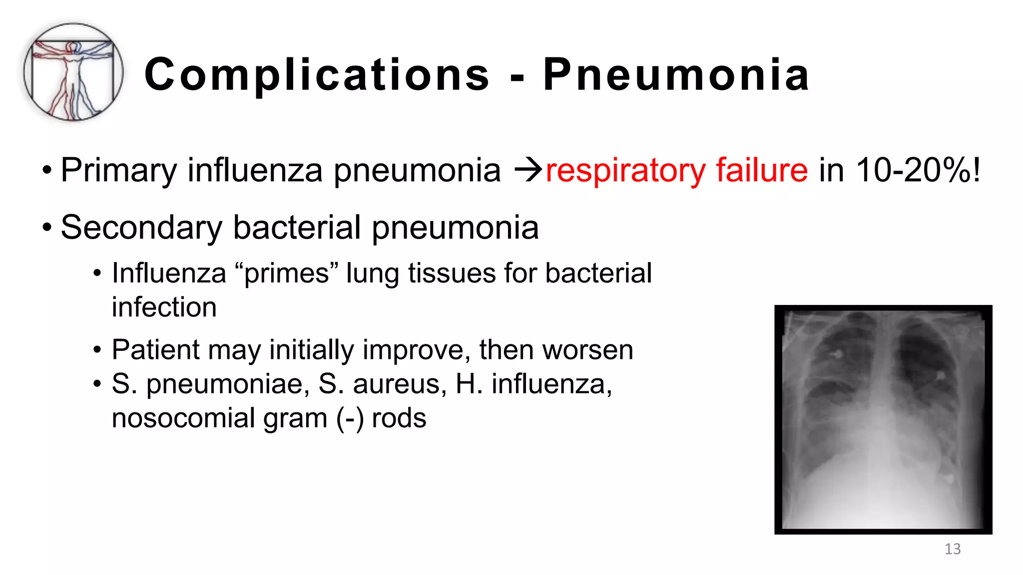 2. Influenza - Pathogenesis and Clinical manifestations.pptx