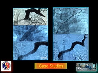 Division of Peripheral Vascular & Endovascular Sciences | PDF | Blood ...
