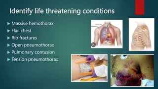 2. Revathi Nair.pptx