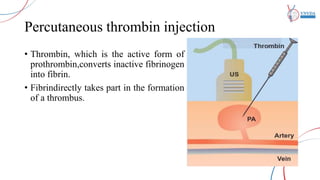 Intervention for Arterial Pseudoaneurysm | PDF