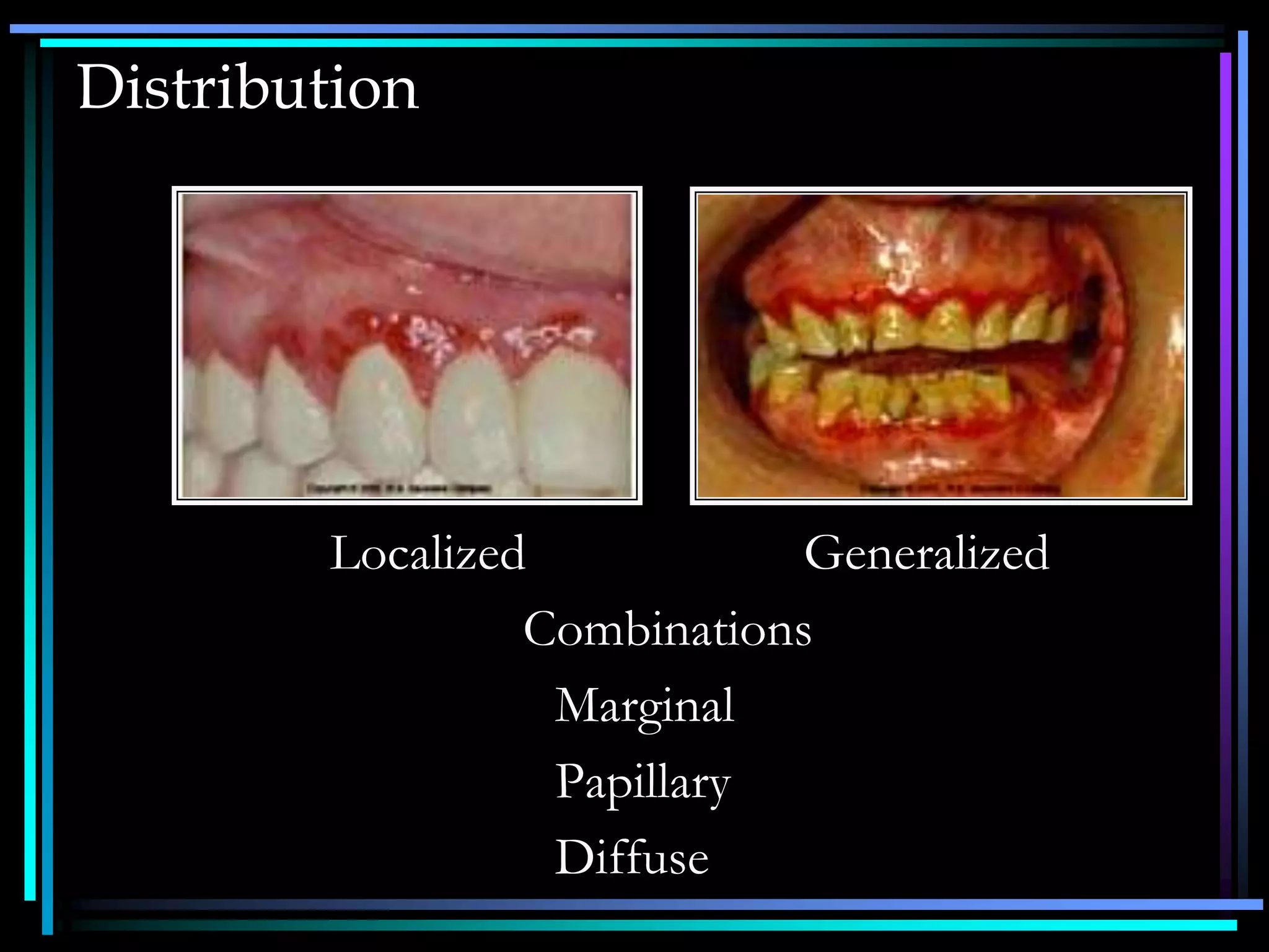 2.clinical features of gingivitis.ppt