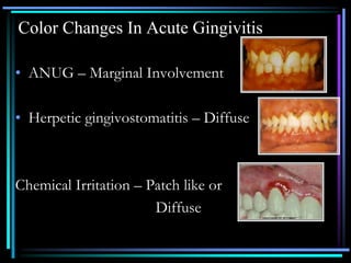 2.clinical features of gingivitis.ppt