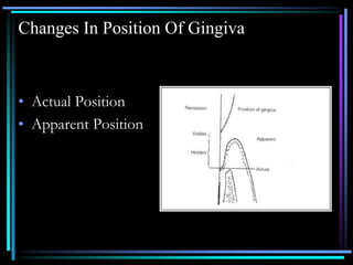 2.clinical features of gingivitis.ppt