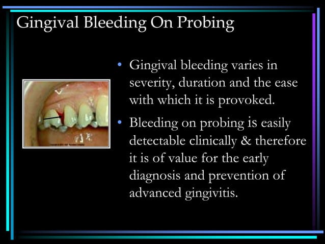 2.clinical features of gingivitis.ppt