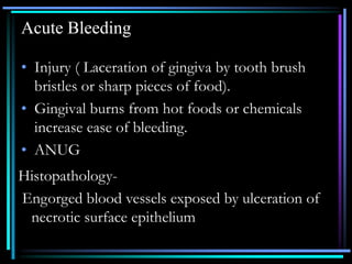 2.clinical features of gingivitis.ppt