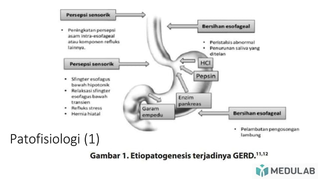 2. Gangguan saluran cerna.pptx