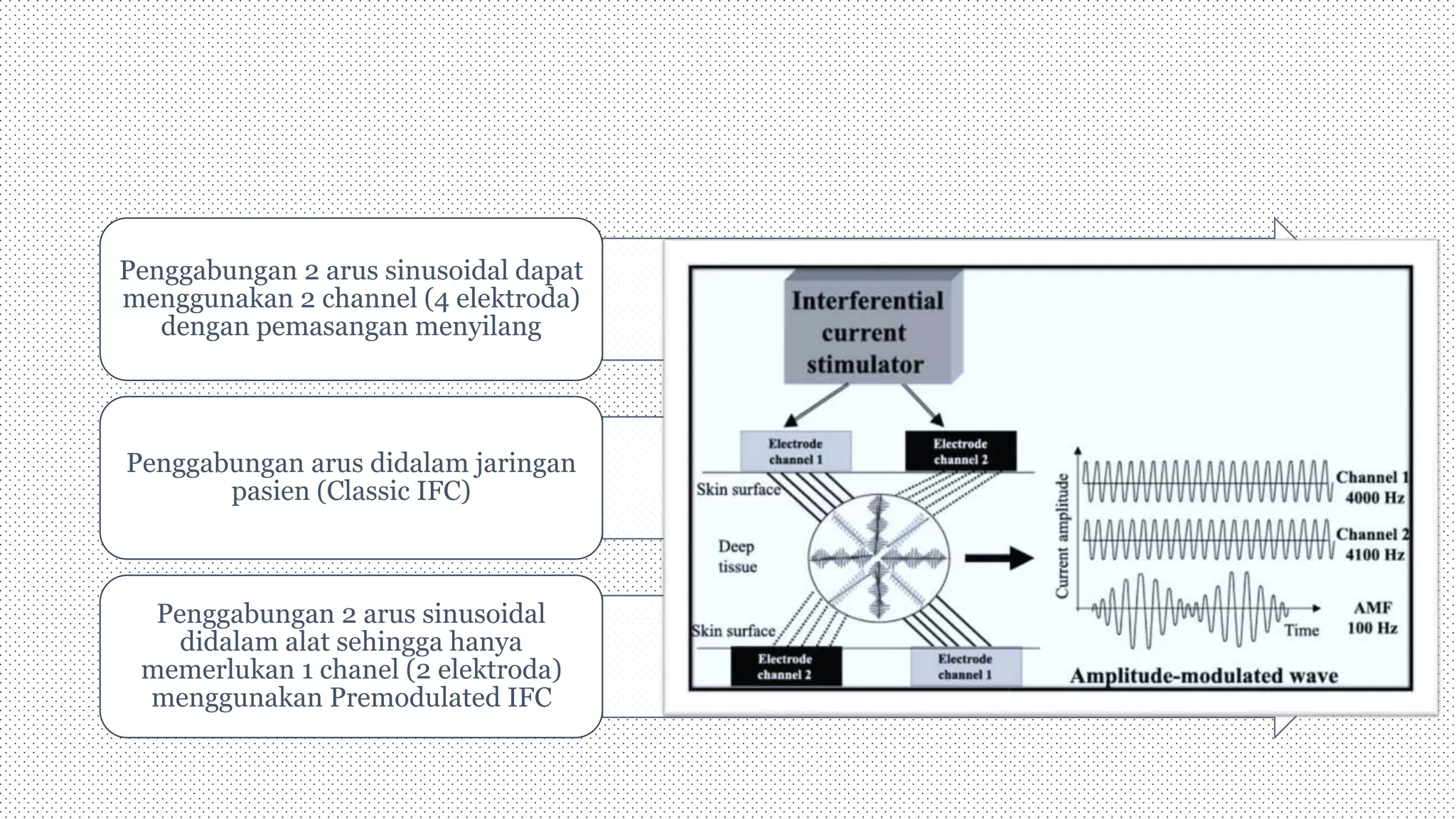 2. Interferential Current.pptx